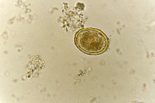 Telur Ascaris Lumbricoides Di Tinja Foto Stok Unduh Gambar Sekarang