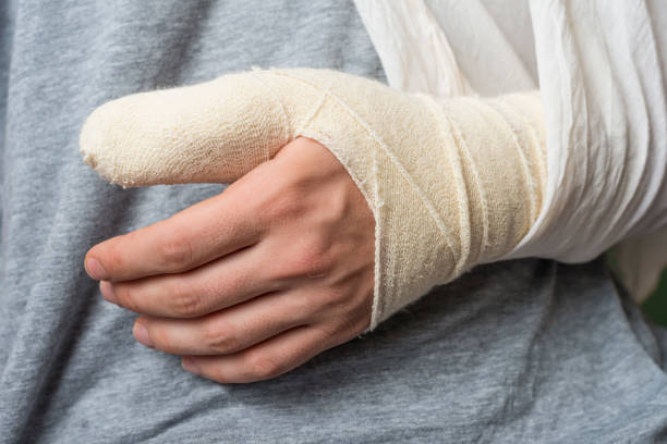 Free picture: hand, finger, broken, plaster