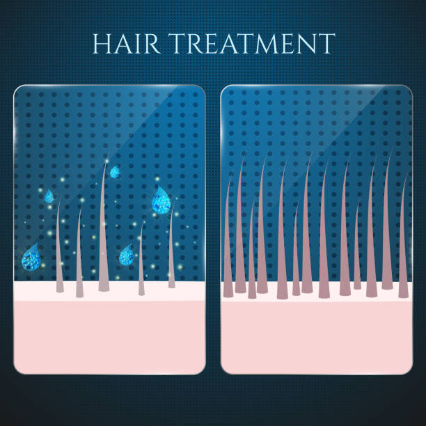 1 400 Human Hair Follicle Stock Illustrations Royalty Free Vector