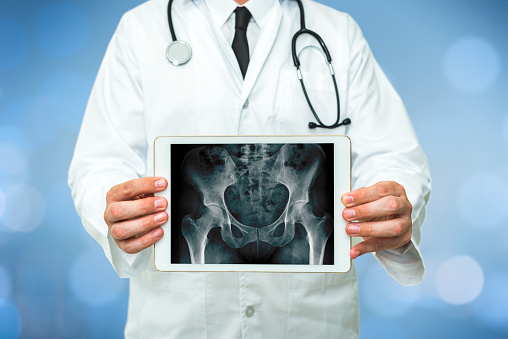 Dokter Menunjukkan Xray Pinggul Pada Tablet Digital Dengan Darurat ... Dokter Menunjukkan Xray Pinggul Pada Tablet Digital Dengan Darurat ...