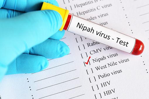 Nipah 바이러스 테스트에 대 한 혈액 샘플 튜브 건강 진단에 대한 스톡 사진 및 기타 이미지 건강 진단 건강관리와 의술