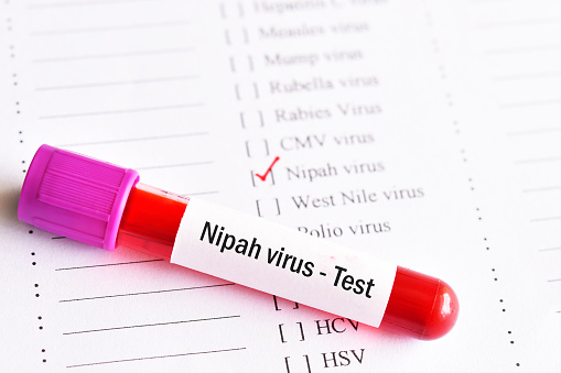 Nipah 바이러스 테스트에 대 한 혈액 샘플 튜브 건강 진단에 대한 스톡 사진 및 기타 이미지 건강 진단 건강관리와 의술