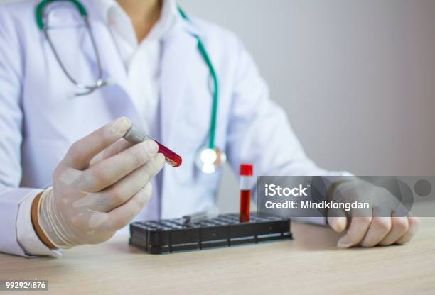 Dokter Memegang Tabung Sampel Darah Dalam Pengujian Tangannya Di