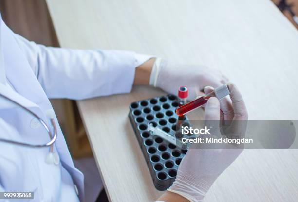 Dokter Memegang Tabung Sampel Darah Dalam Pengujian Tangannya Di