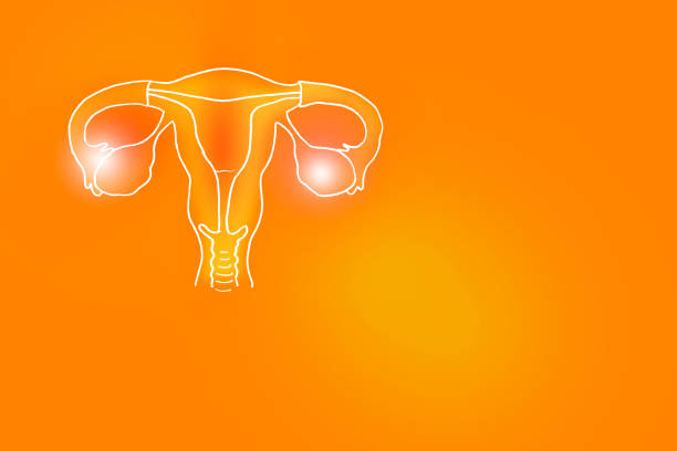 Laparoscopic Surgery Endometriosis Stock Photos, Pictures & Royalty ... Laparoscopic Surgery Endometriosis Stock Photos, Pictures & Royalty ...