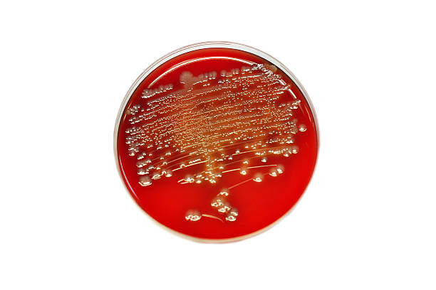 Acinetobacter Stock Photos, Pictures & Royalty-Free Images - iStock Acinetobacter Stock Photos, Pictures & Royalty-Free Images - iStock