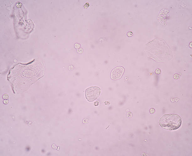 Best Simple Squamous Epithelium Stock Photos, Pictures & Royalty-Free ... Best Simple Squamous Epithelium Stock Photos, Pictures & Royalty-Free ...