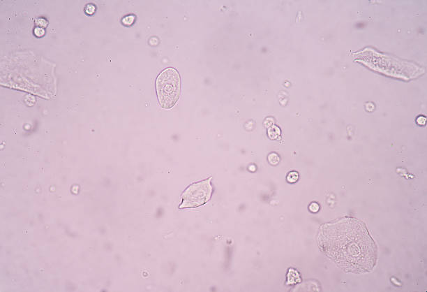 Best Simple Squamous Epithelium Stock Photos, Pictures & Royalty-Free ... Best Simple Squamous Epithelium Stock Photos, Pictures & Royalty-Free ...