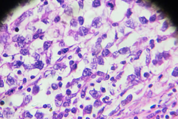 Simple Squamous Epithelium Stock Photos, Pictures & Royalty-Free Images ... Simple Squamous Epithelium Stock Photos, Pictures & Royalty-Free Images ...