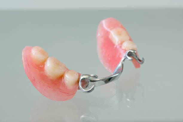 Best Imperfect Teeth Stock Photos, Pictures & Royalty-Free Images - iStock Best Imperfect Teeth Stock Photos, Pictures & Royalty-Free Images - iStock