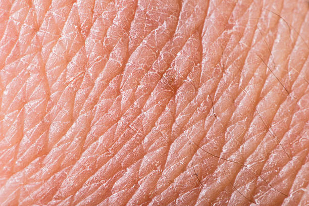 Best Human Skin Surface Stock Photos, Pictures & Royalty-Free Images ... Best Human Skin Surface Stock Photos, Pictures & Royalty-Free Images ...