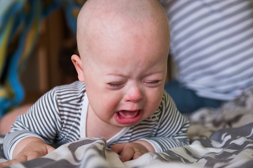 Cute Baby Boy With Down Syndrome Crying Stock Photo - Download Image ... Cute Baby Boy With Down Syndrome Crying Stock Photo - Download Image ...
