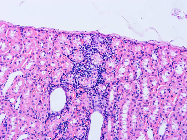 Best Simple Squamous Epithelium Stock Photos, Pictures & Royalty-Free ... Best Simple Squamous Epithelium Stock Photos, Pictures & Royalty-Free ...