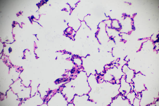 Simple Squamous Epithelium Stock Photos, Pictures & Royalty-Free Images ... Simple Squamous Epithelium Stock Photos, Pictures & Royalty-Free Images ...