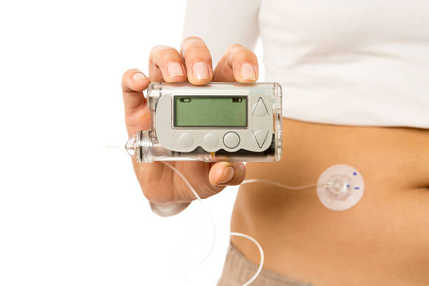 Pompa Insulin Foto Foto Foto Stok, Potret & Gambar Bebas Royalti - iStock Pompa Insulin Foto Foto Foto Stok, Potret & Gambar Bebas Royalti - iStock