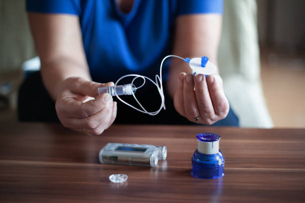 Pompa Insulin Foto Foto Foto Stok, Potret & Gambar Bebas Royalti - iStock Pompa Insulin Foto Foto Foto Stok, Potret & Gambar Bebas Royalti - iStock