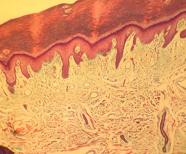 Simple Squamous Epithelium Stock Photos, Pictures & Royalty-Free Images ... Simple Squamous Epithelium Stock Photos, Pictures & Royalty-Free Images ...