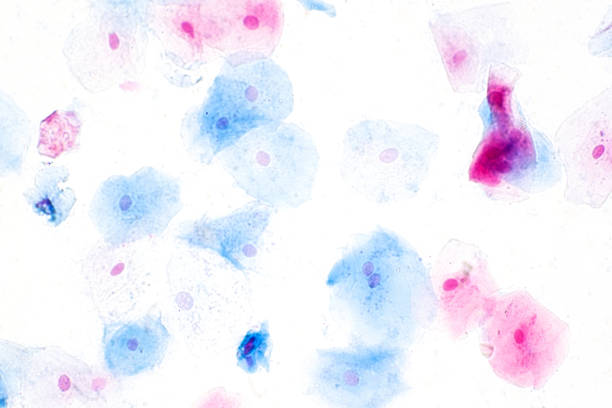 Best Simple Squamous Epithelium Stock Photos, Pictures & Royalty-Free ... Best Simple Squamous Epithelium Stock Photos, Pictures & Royalty-Free ...