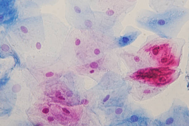 Simple Squamous Epithelium Stock Photos, Pictures & Royalty-Free Images ... Simple Squamous Epithelium Stock Photos, Pictures & Royalty-Free Images ...