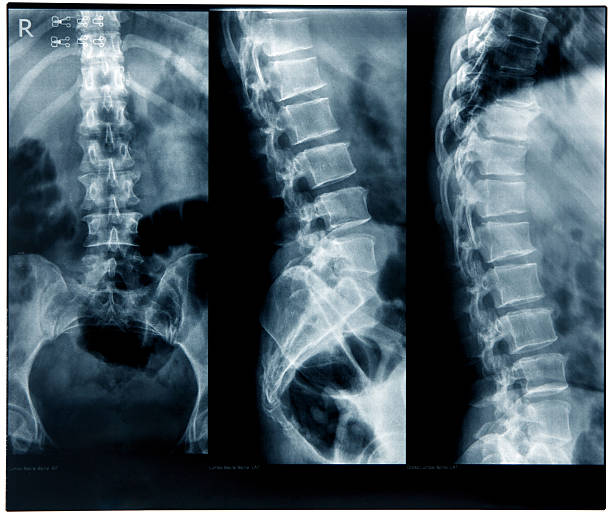 Human Skeleton Banque d'images et photos libres de droit - iStock Human Skeleton Banque d'images et photos libres de droit - iStock