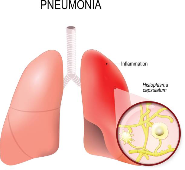 Royalty Free Pulmonary Circulation Clip Art, Vector Images ... Royalty Free Pulmonary Circulation Clip Art, Vector Images ...