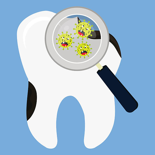 Best Tooth Decay Illustrations, Royalty-Free Vector Graphics & Clip Art ... Best Tooth Decay Illustrations, Royalty-Free Vector Graphics & Clip Art ...