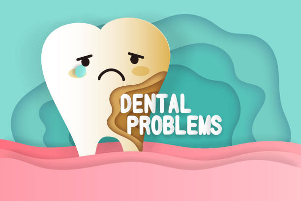 Best Tooth Decay Illustrations, Royalty-Free Vector Graphics & Clip Art ... Best Tooth Decay Illustrations, Royalty-Free Vector Graphics & Clip Art ...