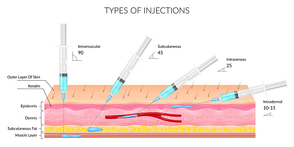 Free Vector Types Of Injections Diagram - vrogue.co Free Vector Types Of Injections Diagram - vrogue.co